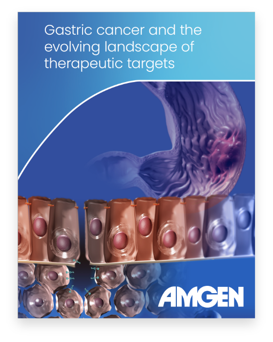 Emerging Protein Biomarker in Gastric/GEJ Cancers - FGFR2b.com